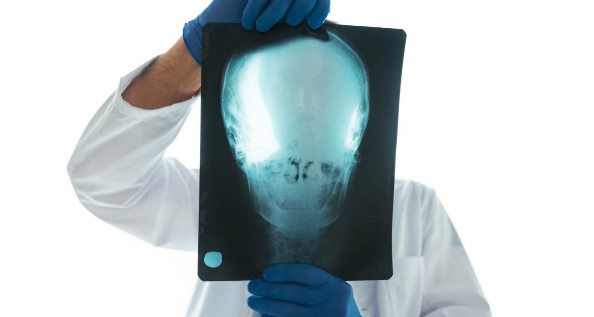 The SA start-up using AI to read X-rays - and save lives - TechCentral ...
